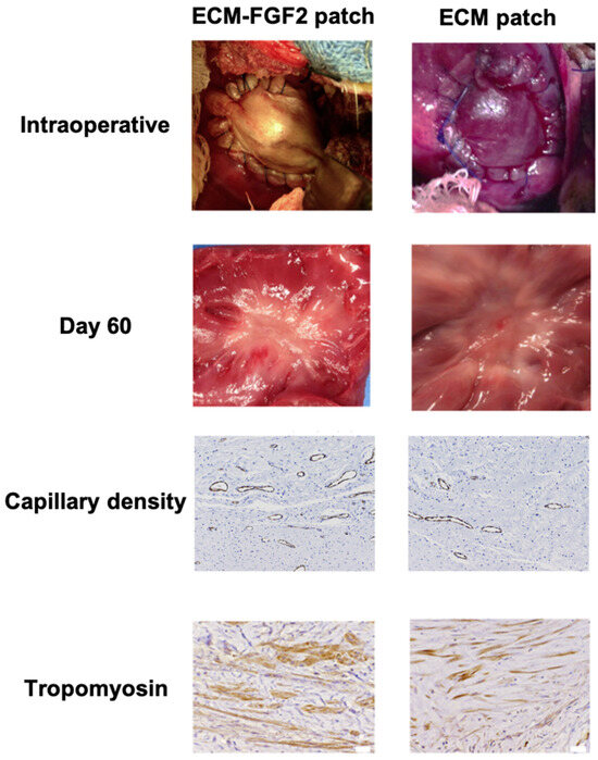 Bridging the Gap: Advances and Challenges in Heart Regeneration from In ...