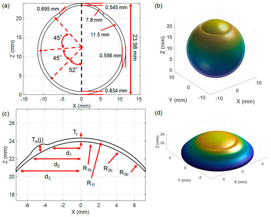 Influence of Contact Lens Parameters on Cornea: Biomechanical Analysis
