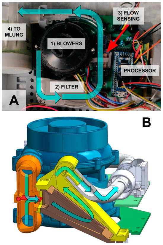 A Wearable Extracorporeal CO2 Removal System with a Closed-Loop Feedback