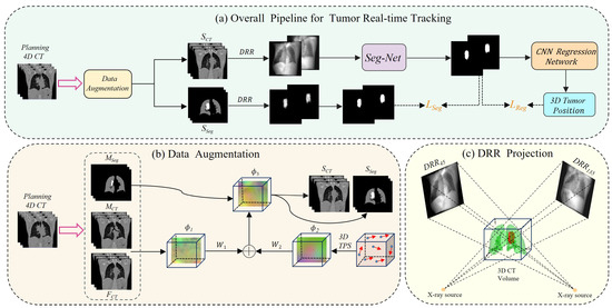 Robust Real-Time Cancer Tracking via Dual-Panel X-Ray Images for Precision Radiotherapy