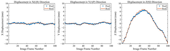 Robust Real-Time Cancer Tracking via Dual-Panel X-Ray Images for ...