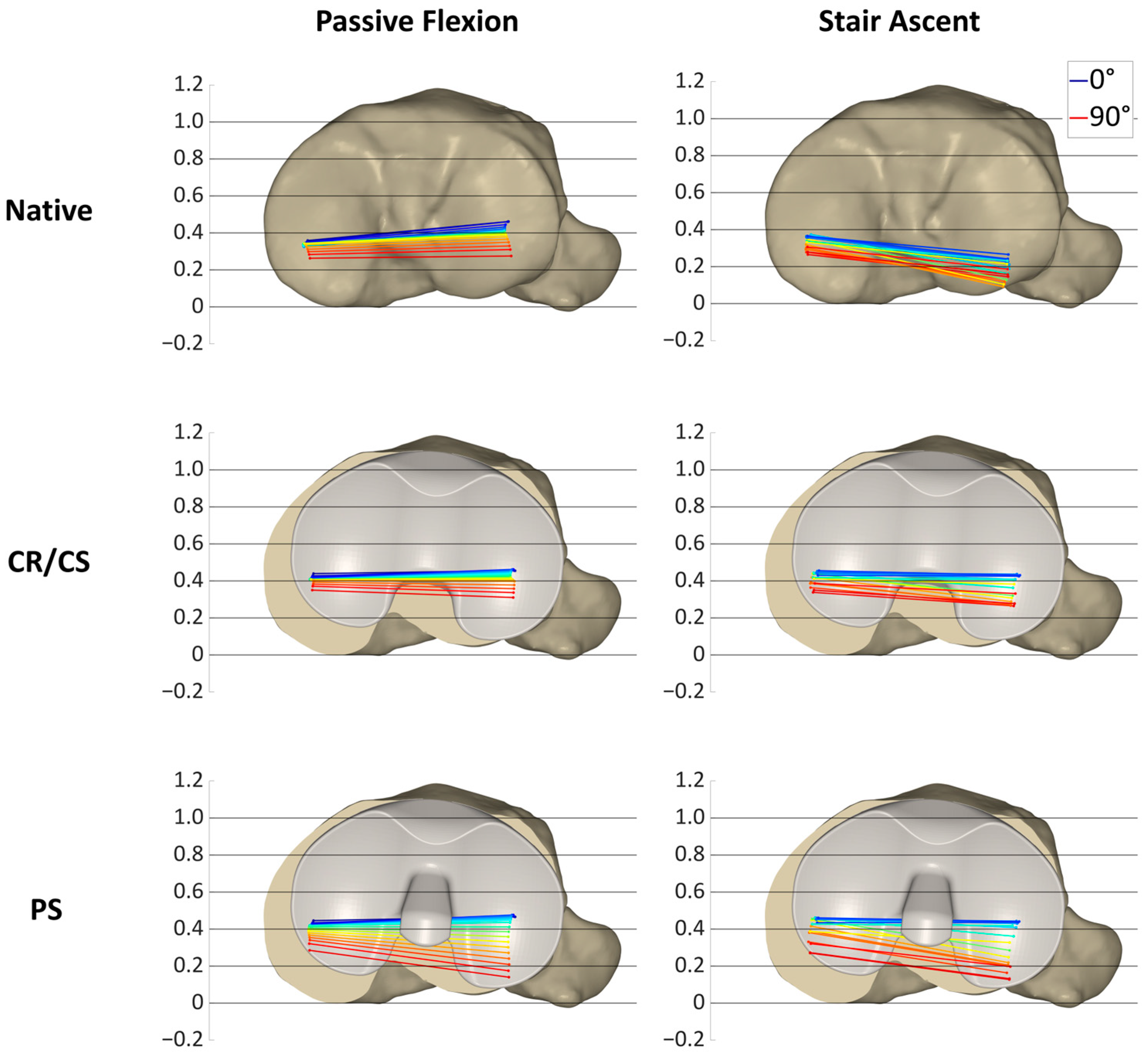 Kinematic Patterns of Different Loading Profiles Before and After Total ...