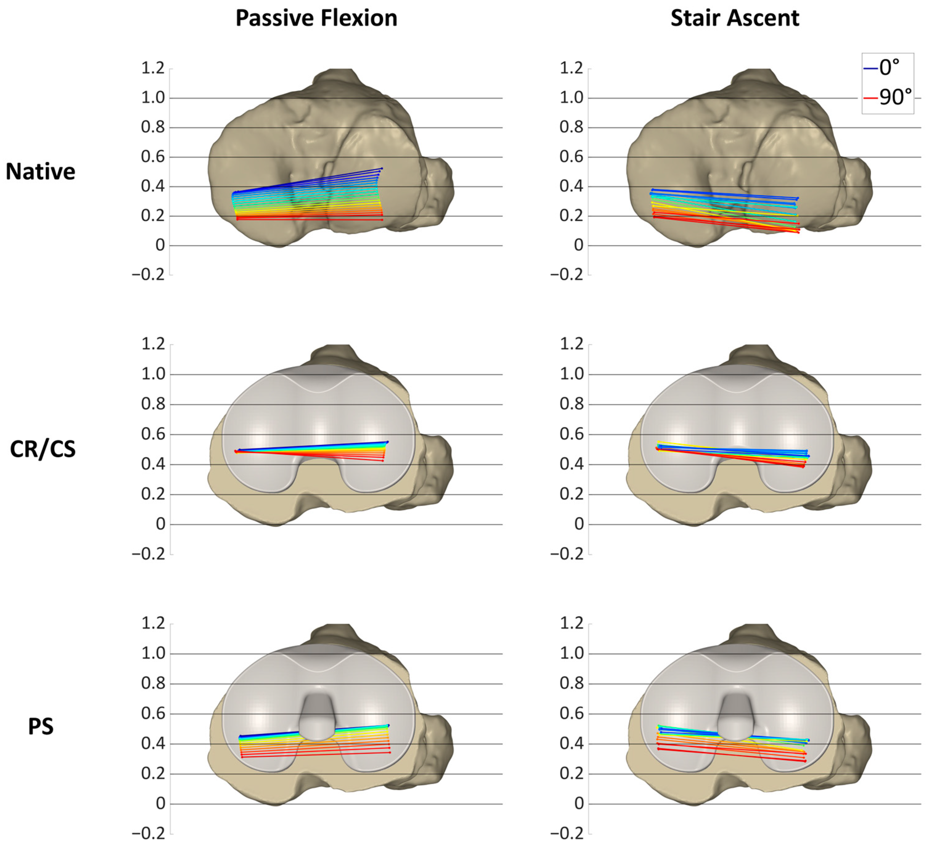 Kinematic Patterns of Different Loading Profiles Before and After Total ...