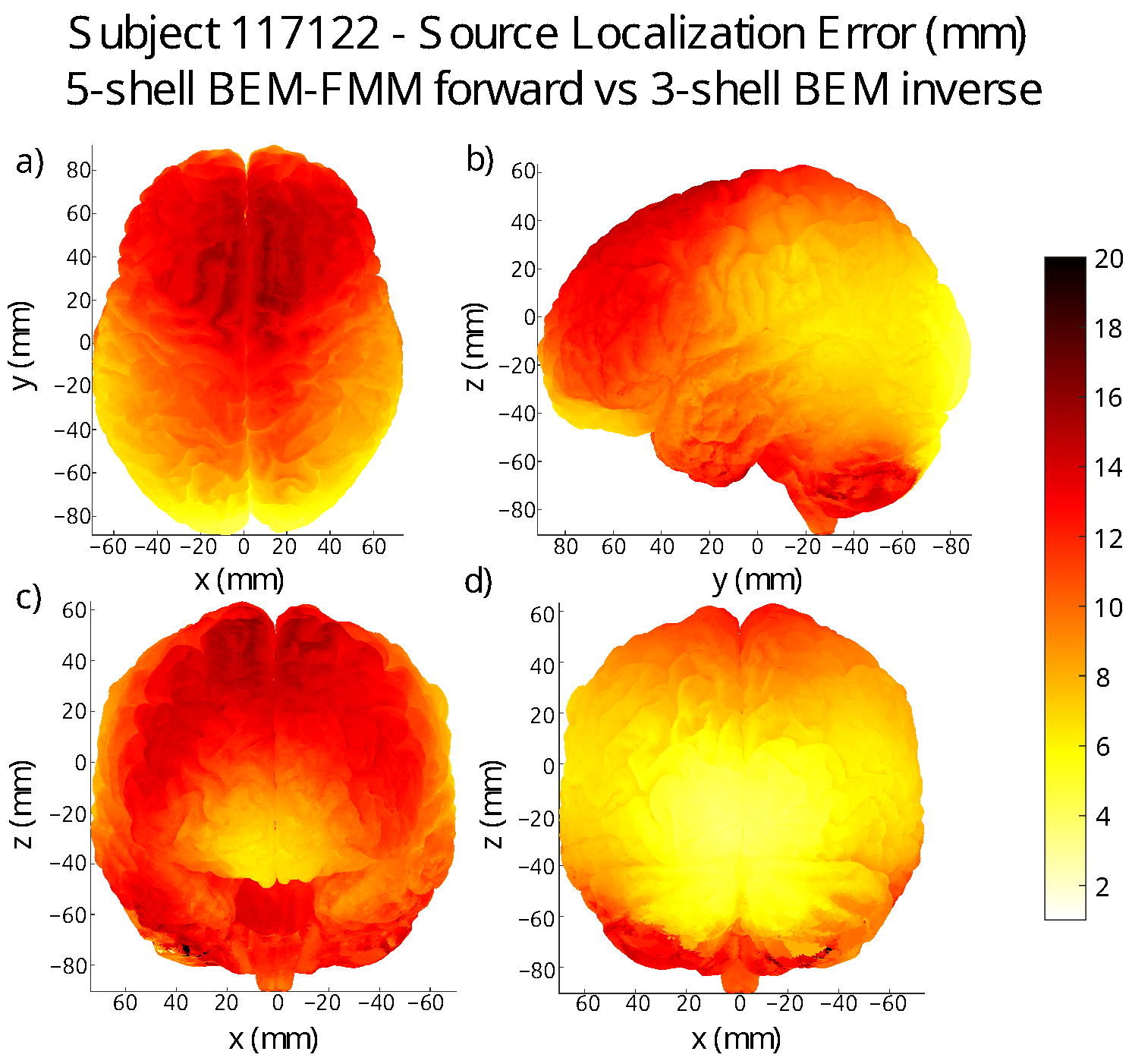 Improving EEG Forward Modeling Using High-Resolution Five-Layer BEM-FMM Head Models: Effect on ...
