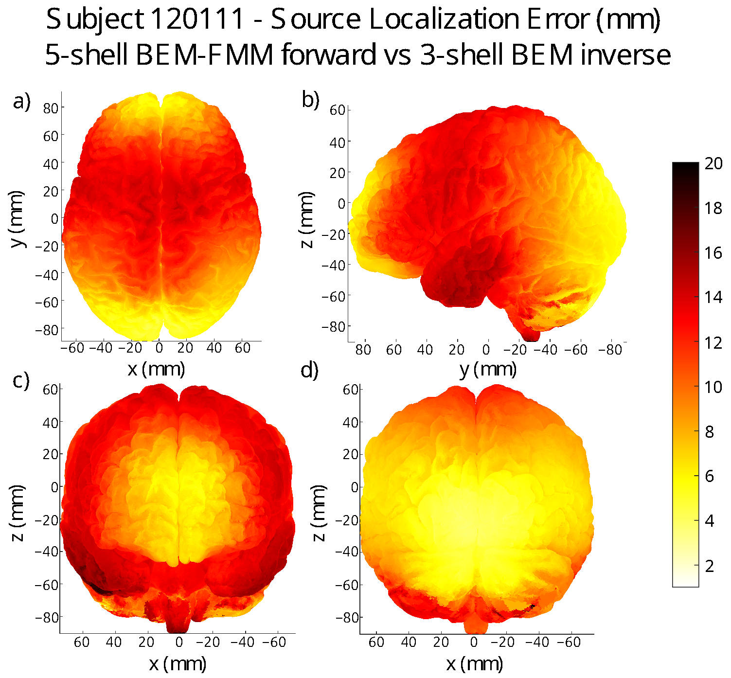 Improving EEG Forward Modeling Using High-Resolution Five-Layer BEM-FMM Head Models: Effect on ...