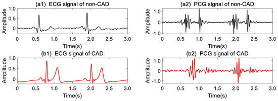 Enhanced CAD Detection Using Novel Multi-Modal Learning: Integration of ...