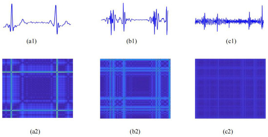 Enhanced CAD Detection Using Novel Multi-Modal Learning: Integration of ...