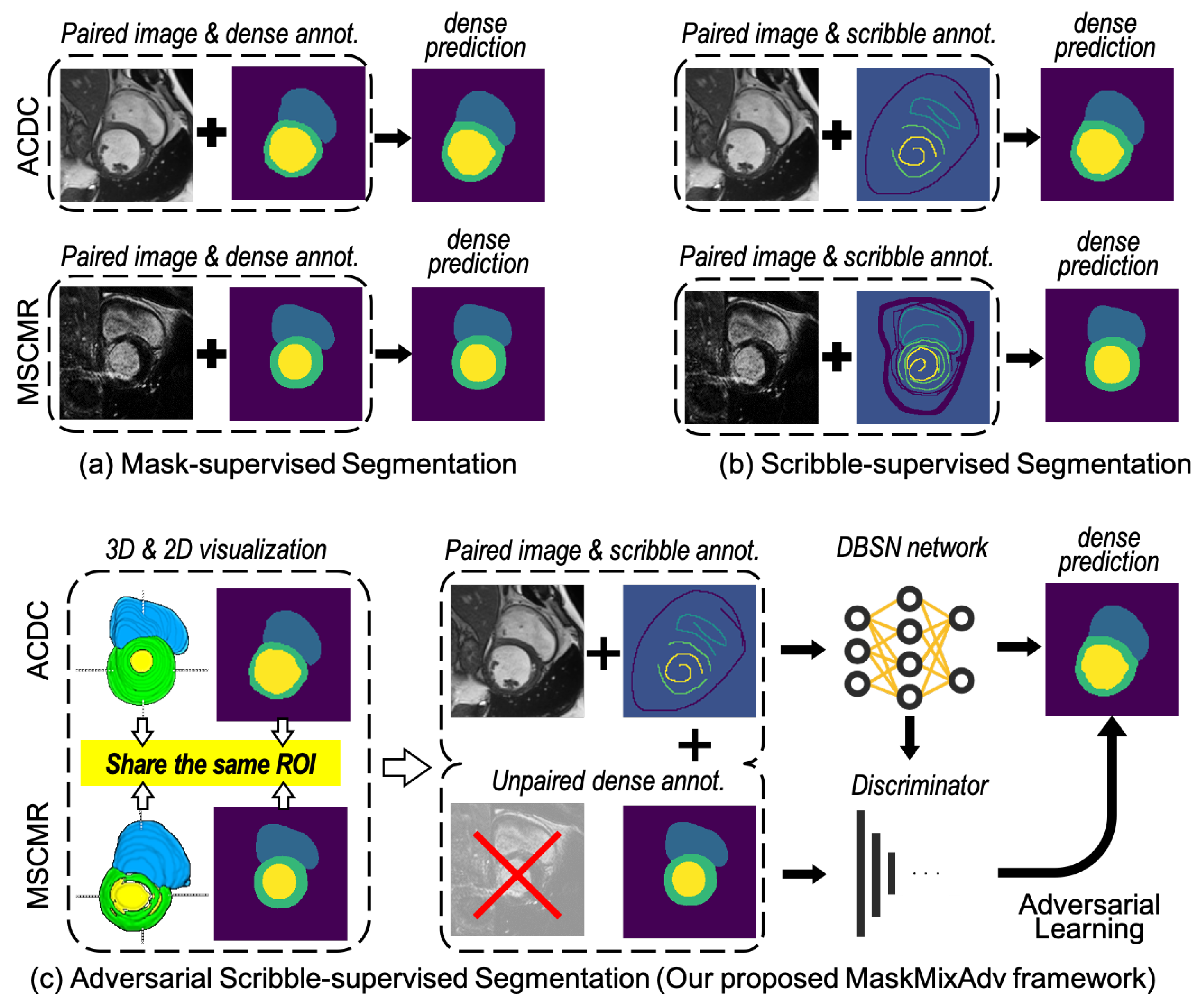 Shape-Aware Adversarial Learning for Scribble-Supervised Medical Image Segmentation with a ...