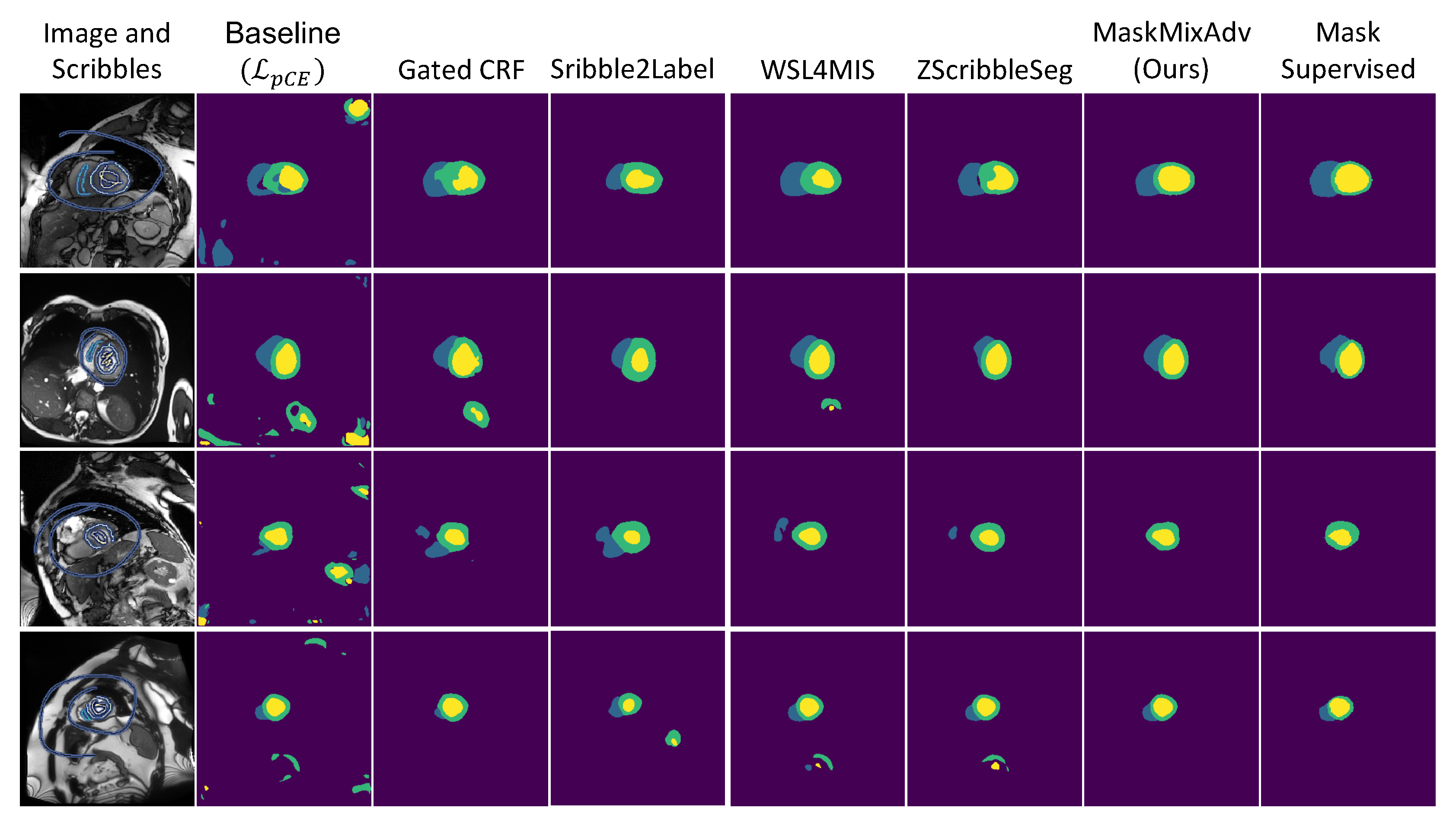 Shape-Aware Adversarial Learning for Scribble-Supervised Medical Image Segmentation with a ...