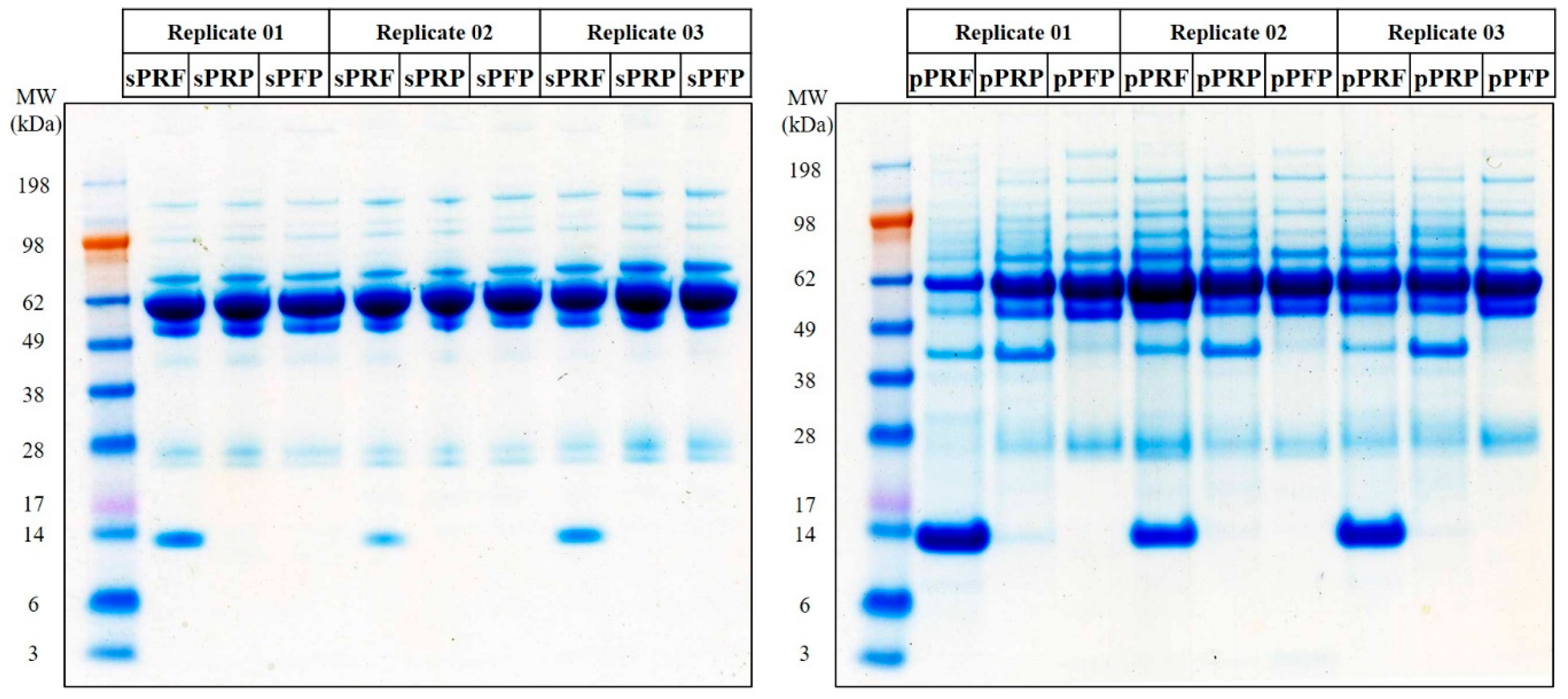 First- vs. Second-Generation Autologous Platelet Concentrates and Their ...