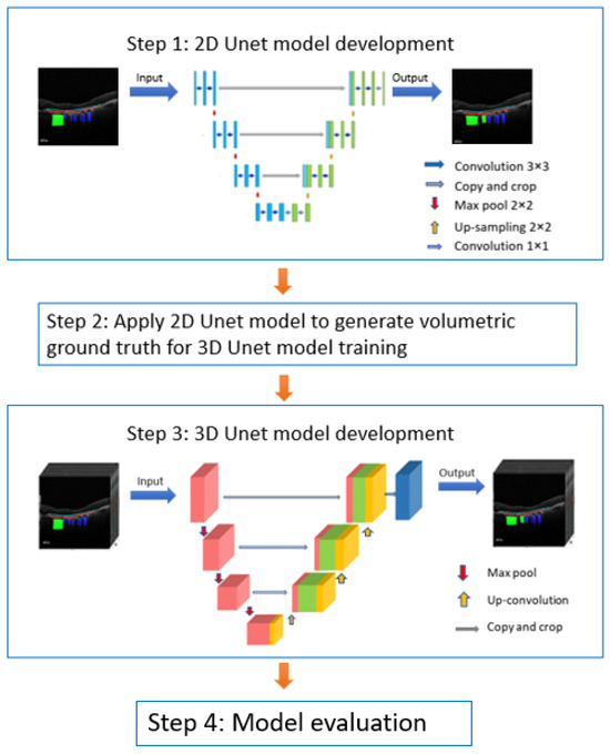 Early Detection of Macular Atrophy Automated Through 2D and 3D Unet ...