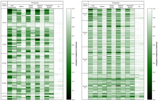 Enhancing Radiomics Reproducibility: Deep Learning-Based Harmonization of Abdominal Computed ...