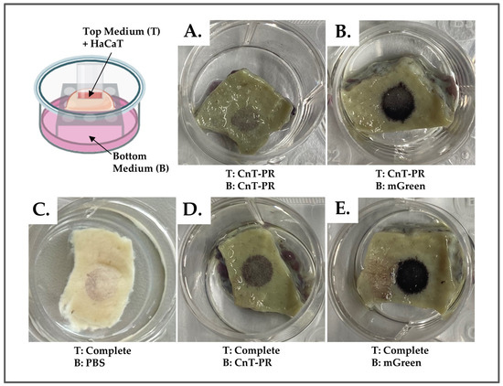 Optimization and Standardization of Stable De-Epidermized Dermis (DED ...