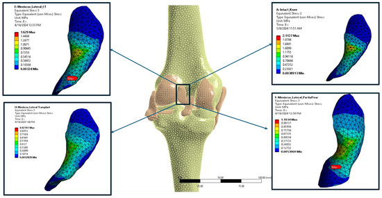 Anterior Cruciate Ligament Mechanical Response to Load in the Setting ...