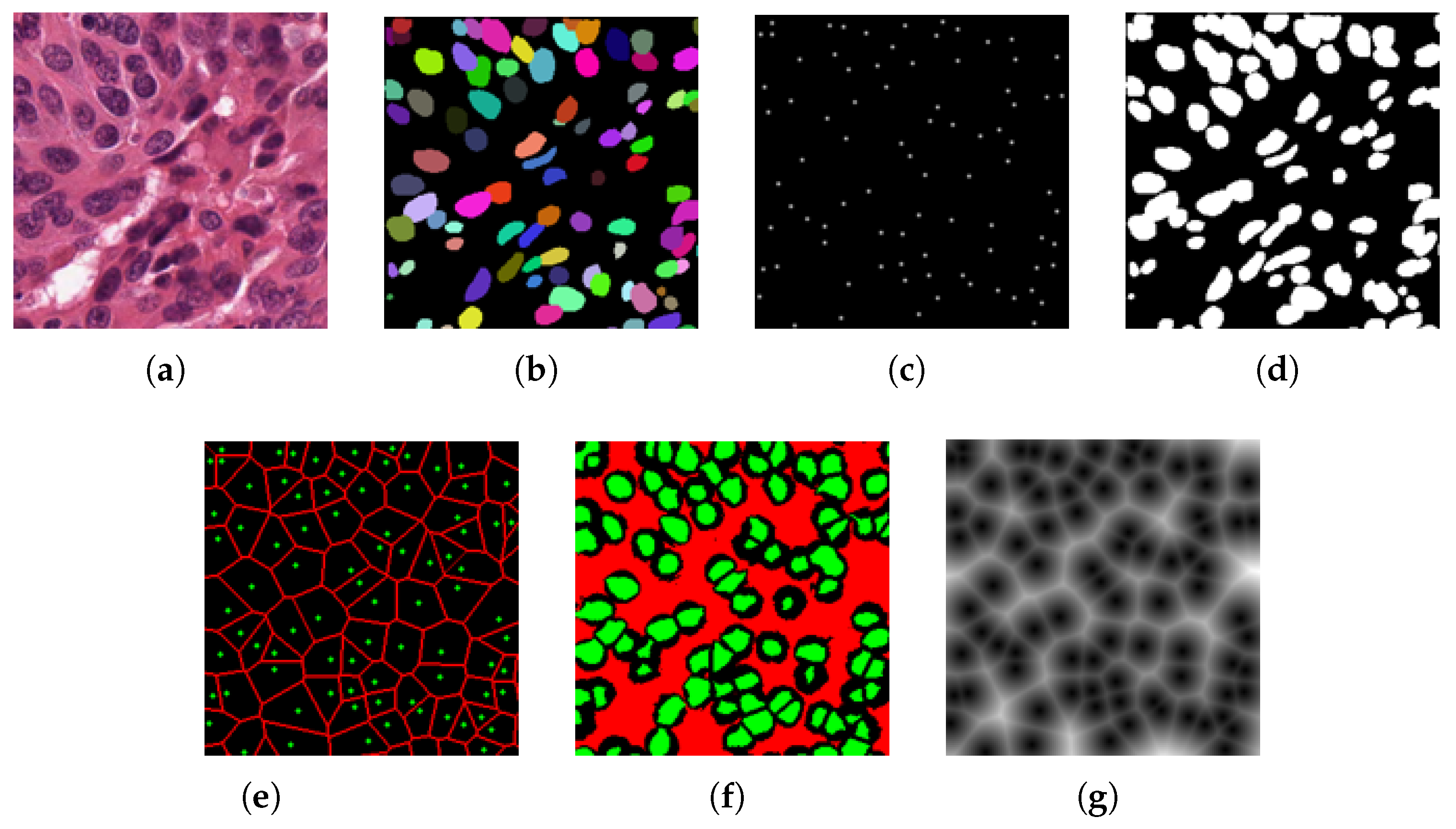 Weakly Supervised Nuclei Segmentation with Point-Guided Attention and Self-Supervised Pseudo ...