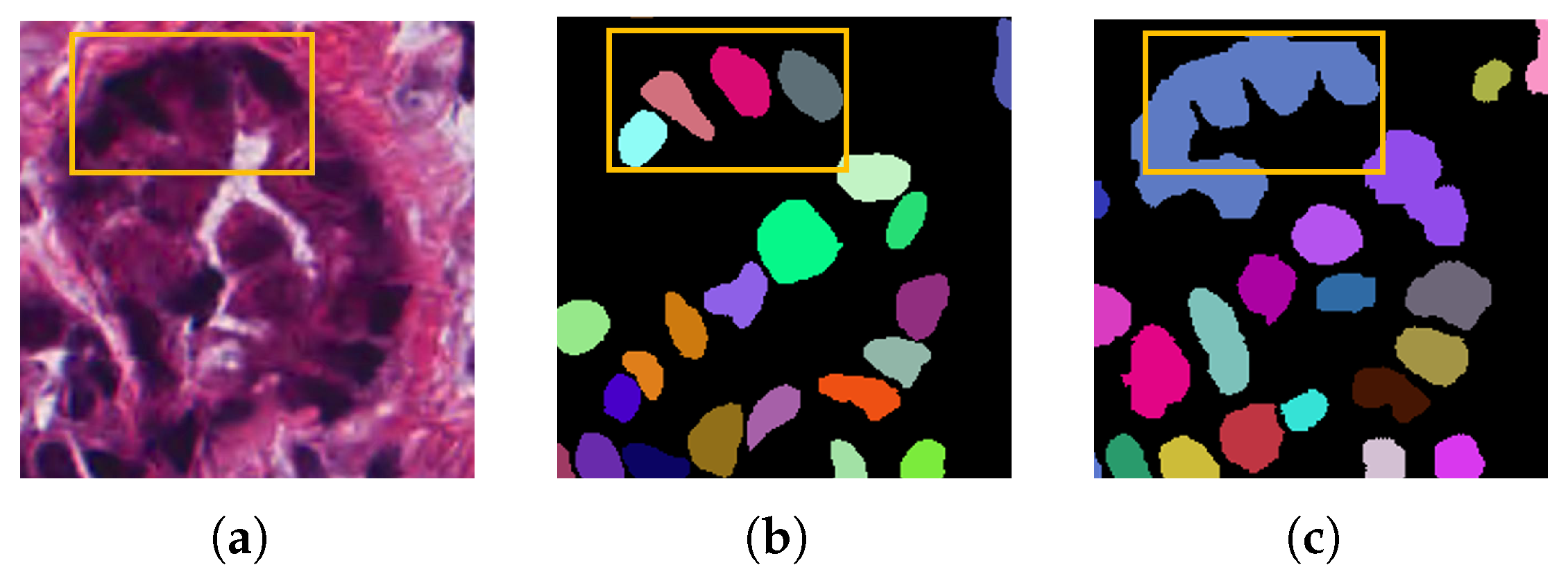 Weakly Supervised Nuclei Segmentation with Point-Guided Attention and Self-Supervised Pseudo ...