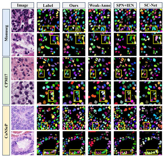 Weakly Supervised Nuclei Segmentation with Point-Guided Attention and Self-Supervised Pseudo ...