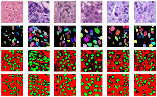 Weakly Supervised Nuclei Segmentation with Point-Guided Attention and Self-Supervised Pseudo ...