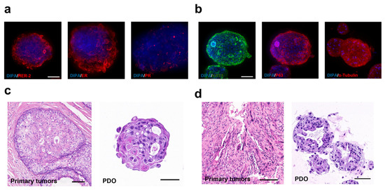 Treatment Response to Oncolytic Virus in Patient-Derived Breast Cancer ...