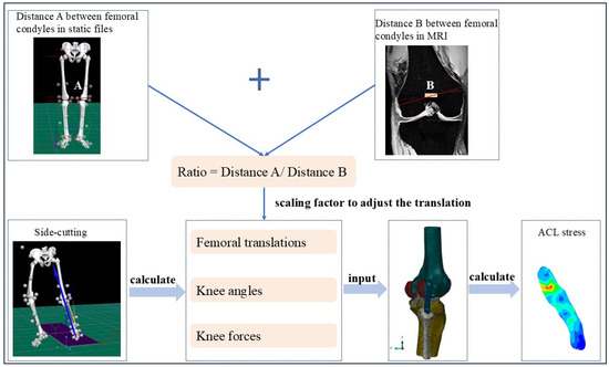 Biomechanical Determinants of Anterior Cruciate Ligament Stress in ...