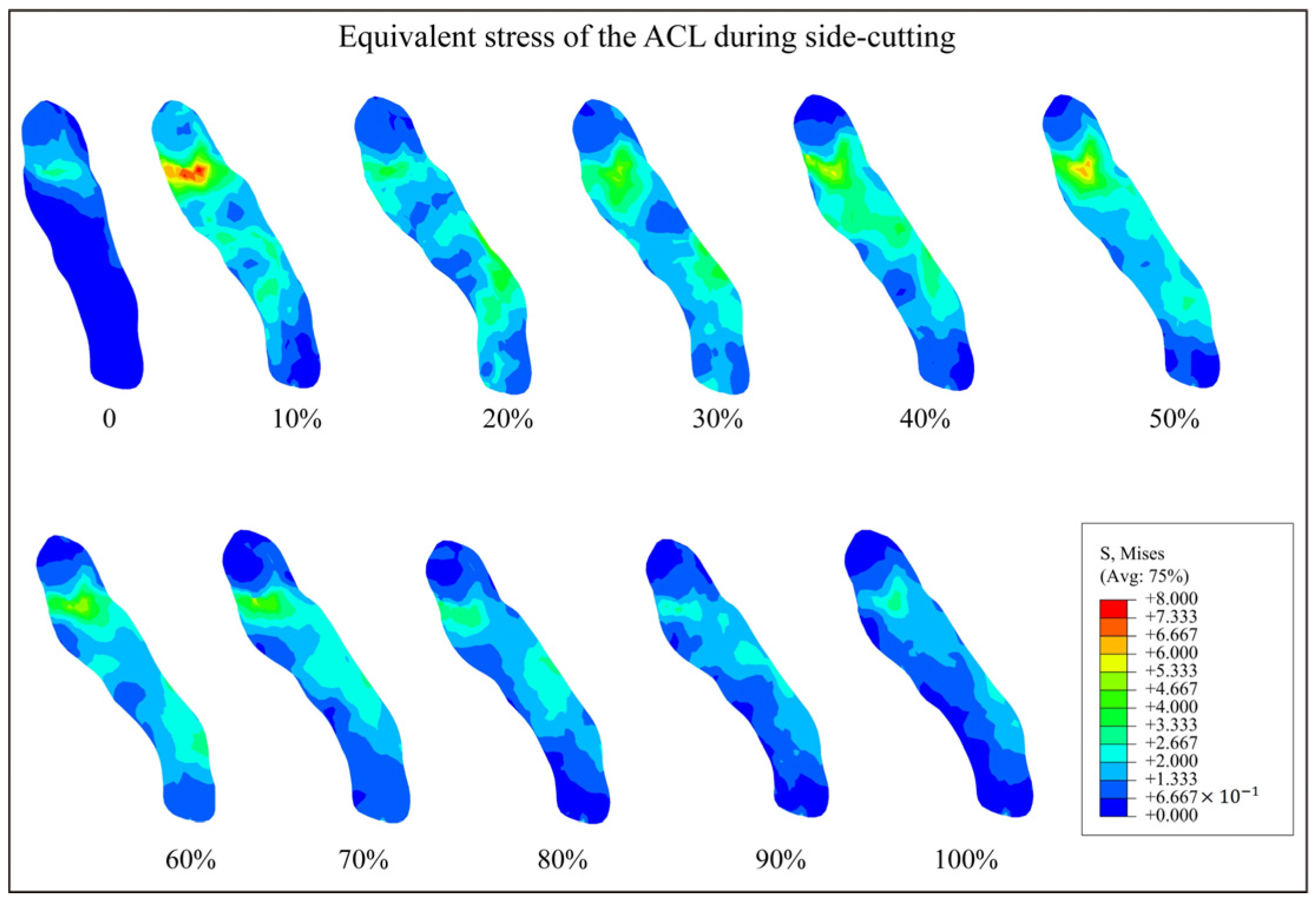 Biomechanical Determinants of Anterior Cruciate Ligament Stress in ...