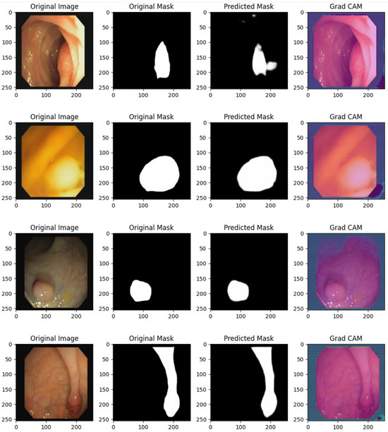 A Method for Polyp Segmentation Through U-Net Network