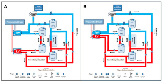 Increased VA-ECMO Pump Speed Reduces Left Atrial Pressure: Insights ...