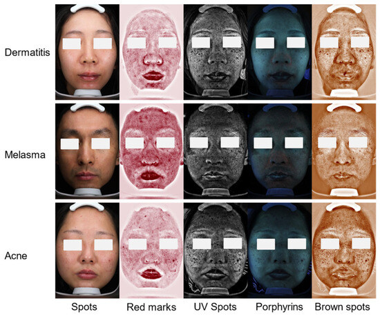 Deep Multi-Modal Skin-Imaging-Based Information-Switching Network for ...