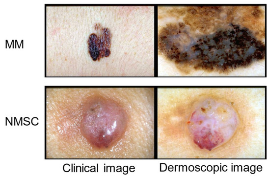Deep Multi-Modal Skin-Imaging-Based Information-Switching Network for ...