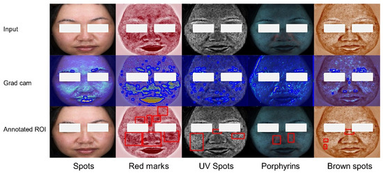 Deep Multi-Modal Skin-Imaging-Based Information-Switching Network for ...