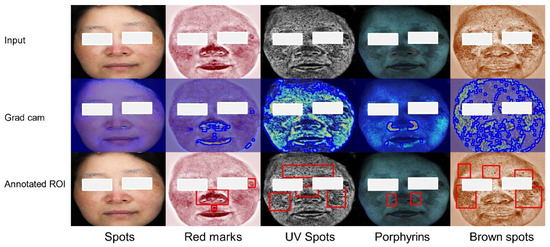 Deep Multi-Modal Skin-Imaging-Based Information-Switching Network for ...