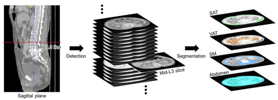 Optimization-Incorporated Deep Learning Strategy to Automate L3 Slice ...