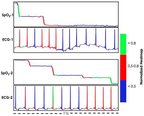 An Explainable Fusion of ECG and SpO2-Based Models for Real-Time Sleep ...