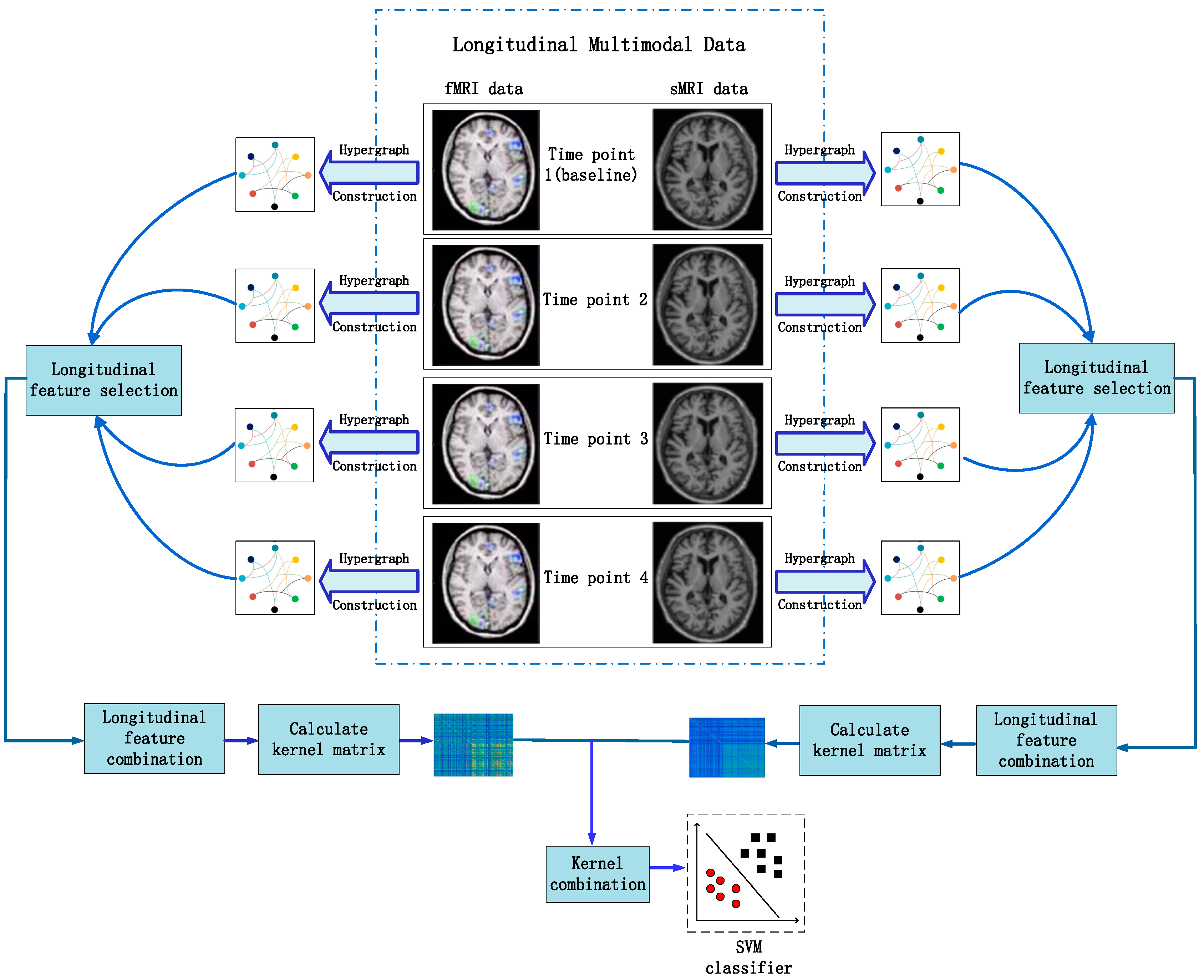Multimodal Classification of Alzheimer’s Disease Using Longitudinal Data Analysis and Hypergraph ...