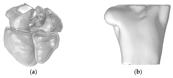 Computational Modeling of Cardiac Electrophysiology with Human ...