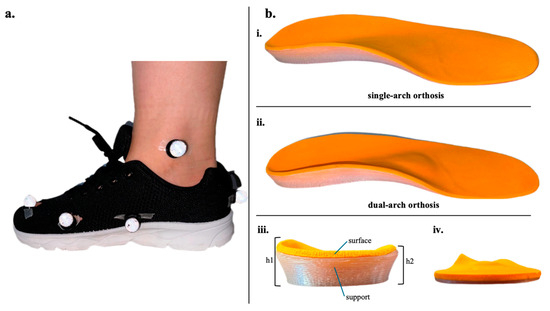 Dual Transverse Arch Foot Orthosis Improves Gait Biomechanics in ...