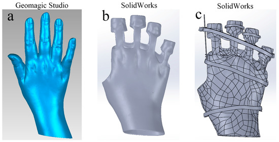 Biomechanical Analysis of Rheumatoid Arthritis of the Hand and the ...