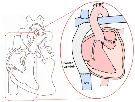 In Vitro and In Silico Analysis of Entrainment Characterization in ...