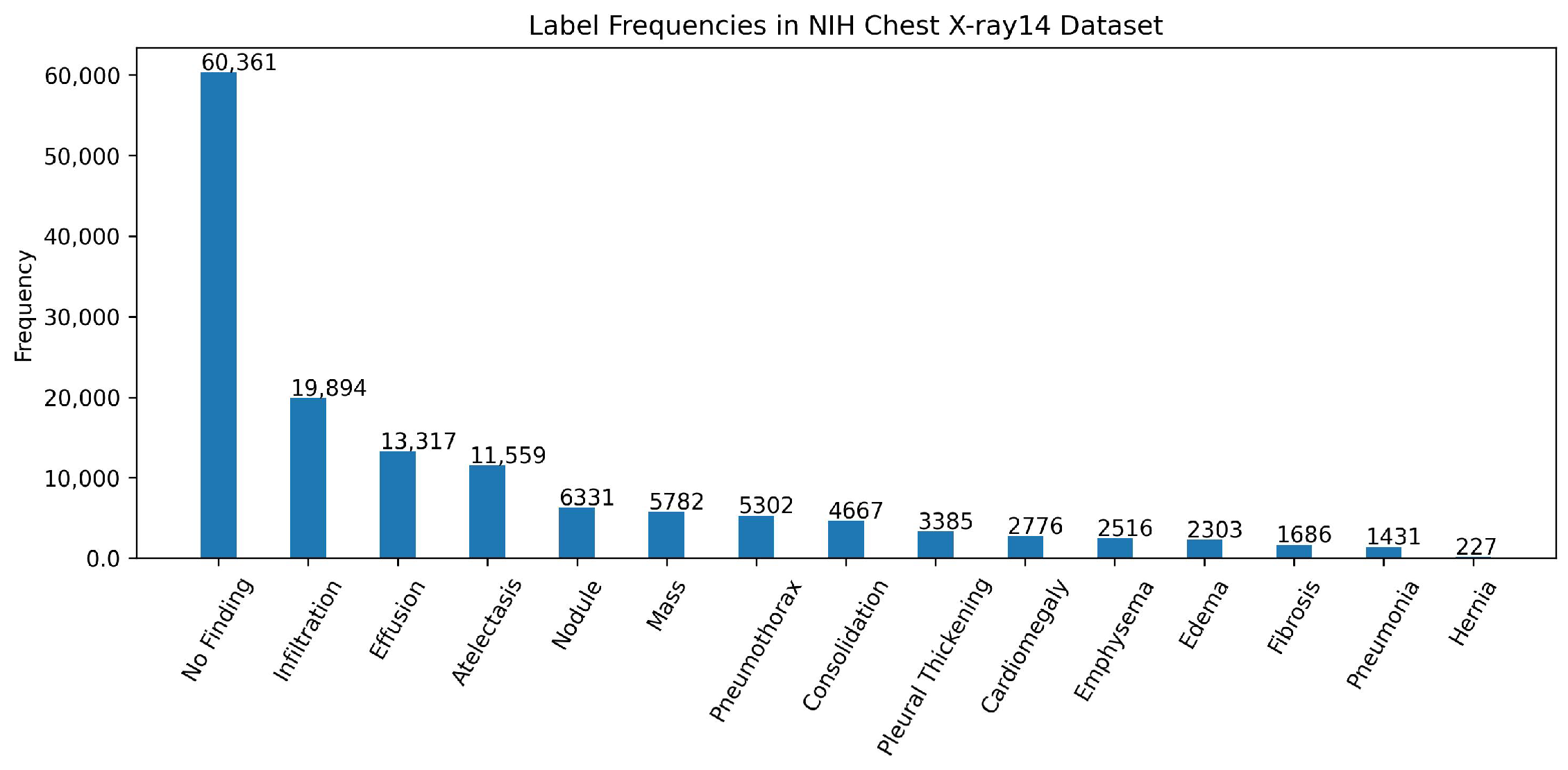 Enhancing Multi-Label Chest X-Ray Classification Using an Improved ...