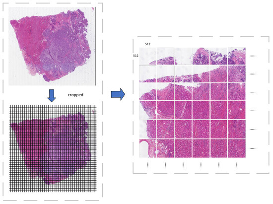 GCSA-SegFormer: Transformer-Based Segmentation for Liver Tumor ...