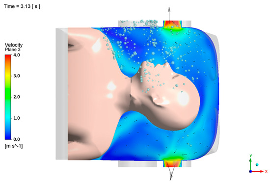 Enhanced Aerosol Containment Performance of a Negative Pressure Hood ...