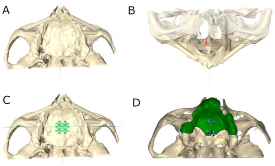 Evaluation of Computer-Aided Navigation and Augmented Reality for ...