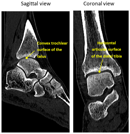 Standardized Morphological Modeling and Simulation-Based Validation of ...