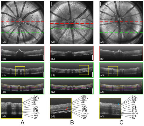 Visible Light Optical Coherence Tomography: Technology and Biomedical ...