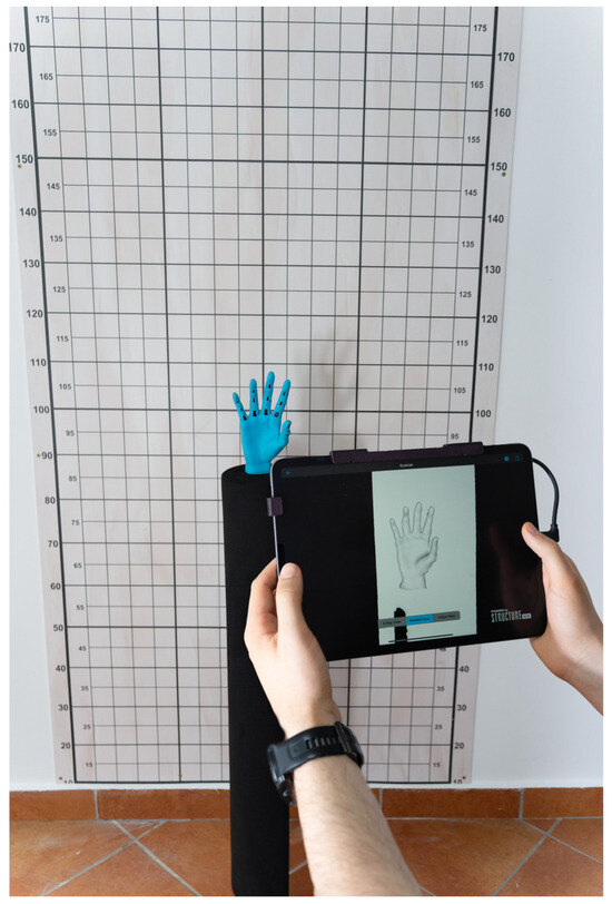 Evaluating 3D Hand Scanning Accuracy Across Trained and Untrained Students