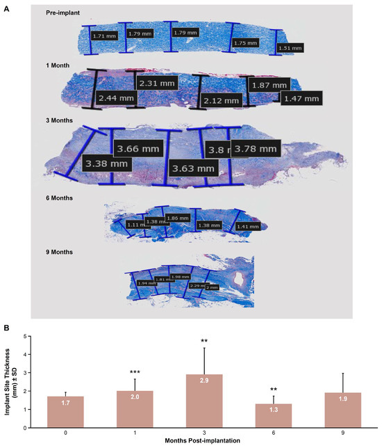 Collagen Remodeling of Strattice™ Firm in a Nonhuman Primate Model of ...