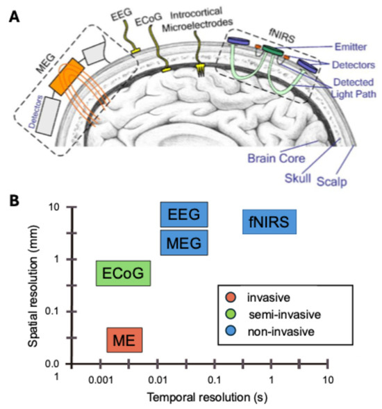 Brain-Computer Interfaces for Stroke Motor Rehabilitation