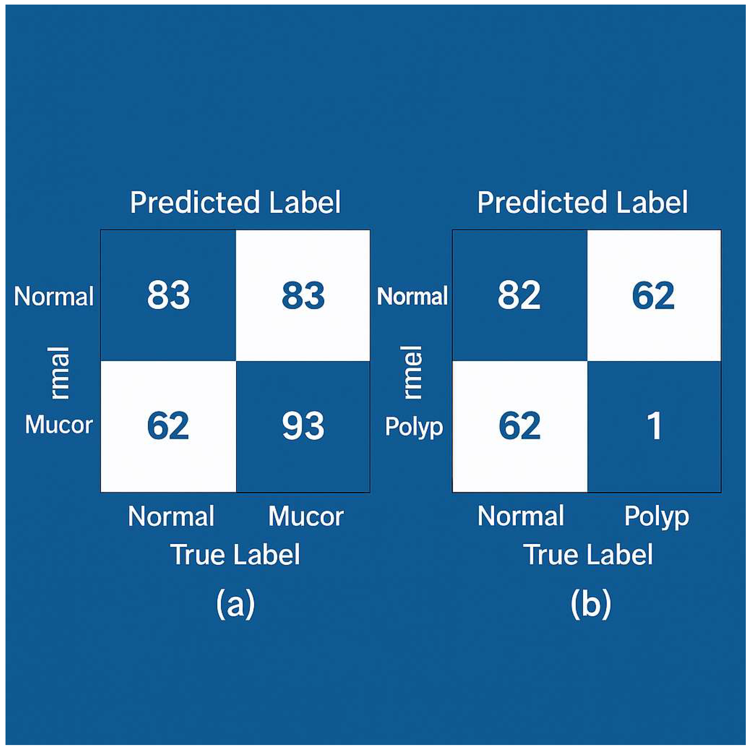 Automated Mucormycosis Diagnosis from Paranasal CT Using ResNet50 and ...