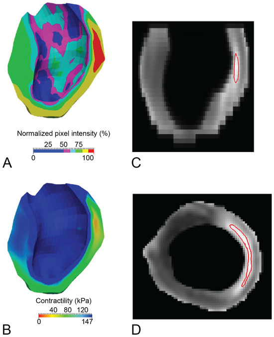Finite Element Modeling in Left Ventricular Cardiac Biomechanics: From ...