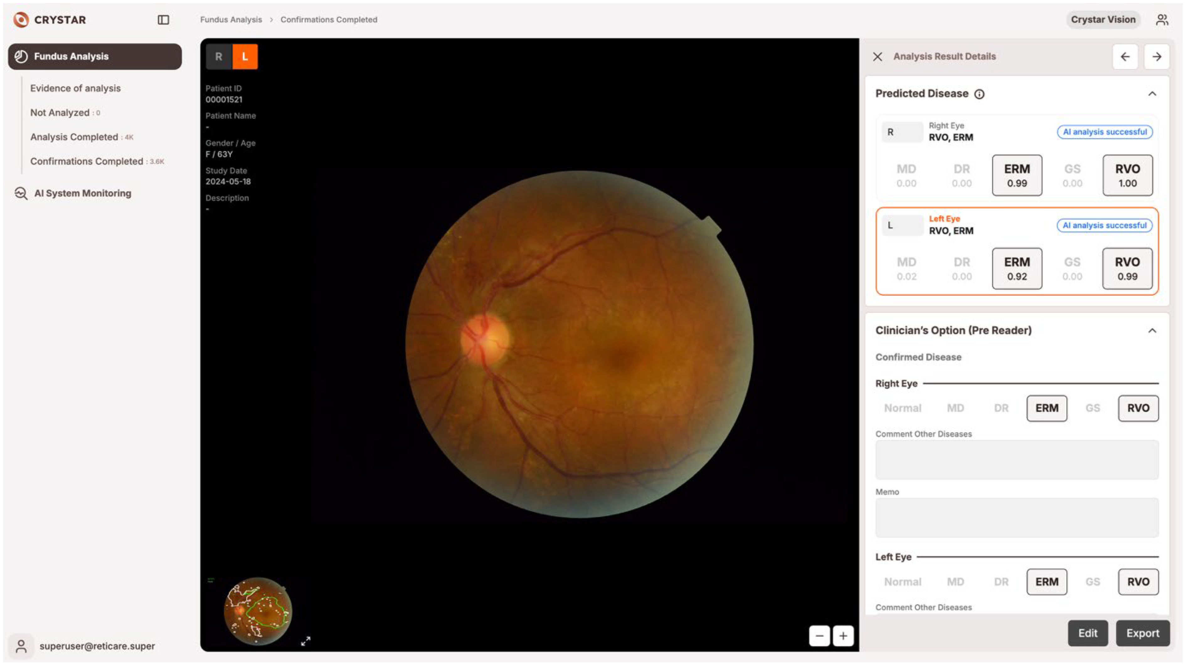 AI-Augmented Fundus Disease Screening by Non-Ophthalmologist Physicians ...